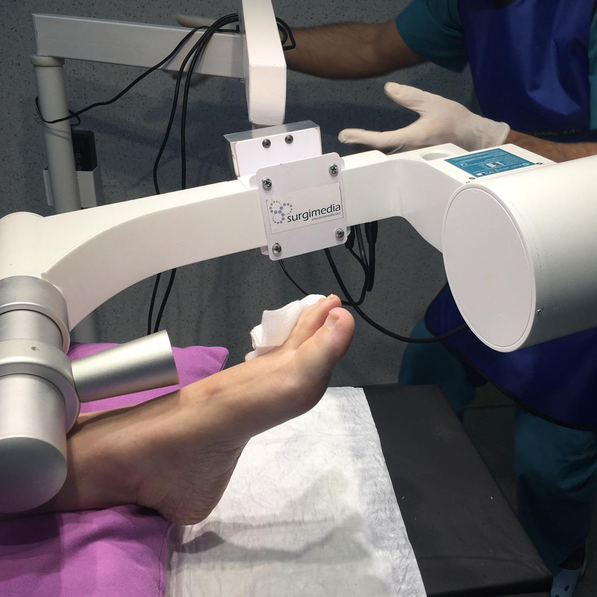 Cirugía percutánea de un heloma interdigital o Ojo de Gallo - Clínica ...